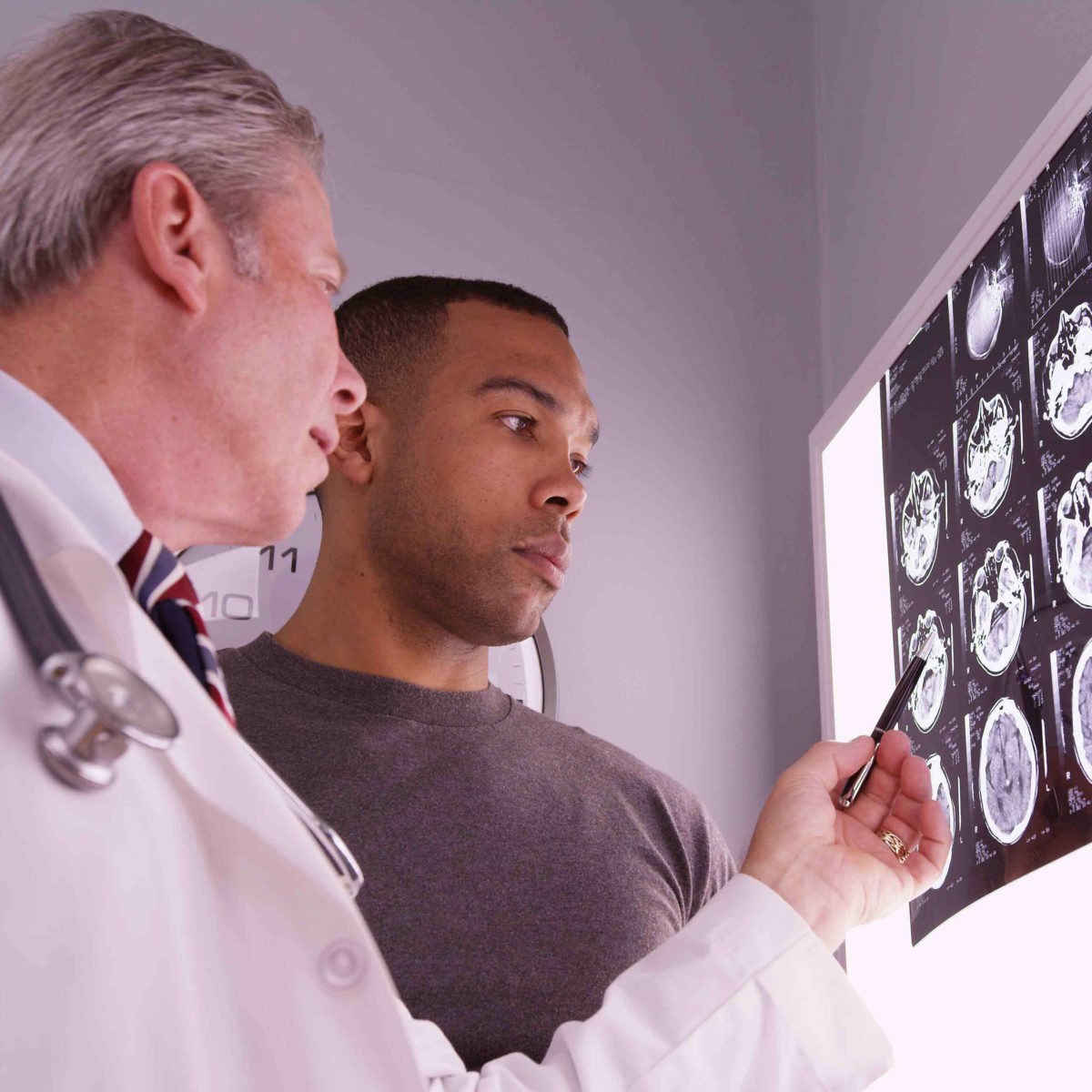 Vertigo and Trigger Points… An Often-Overlooked Relationship