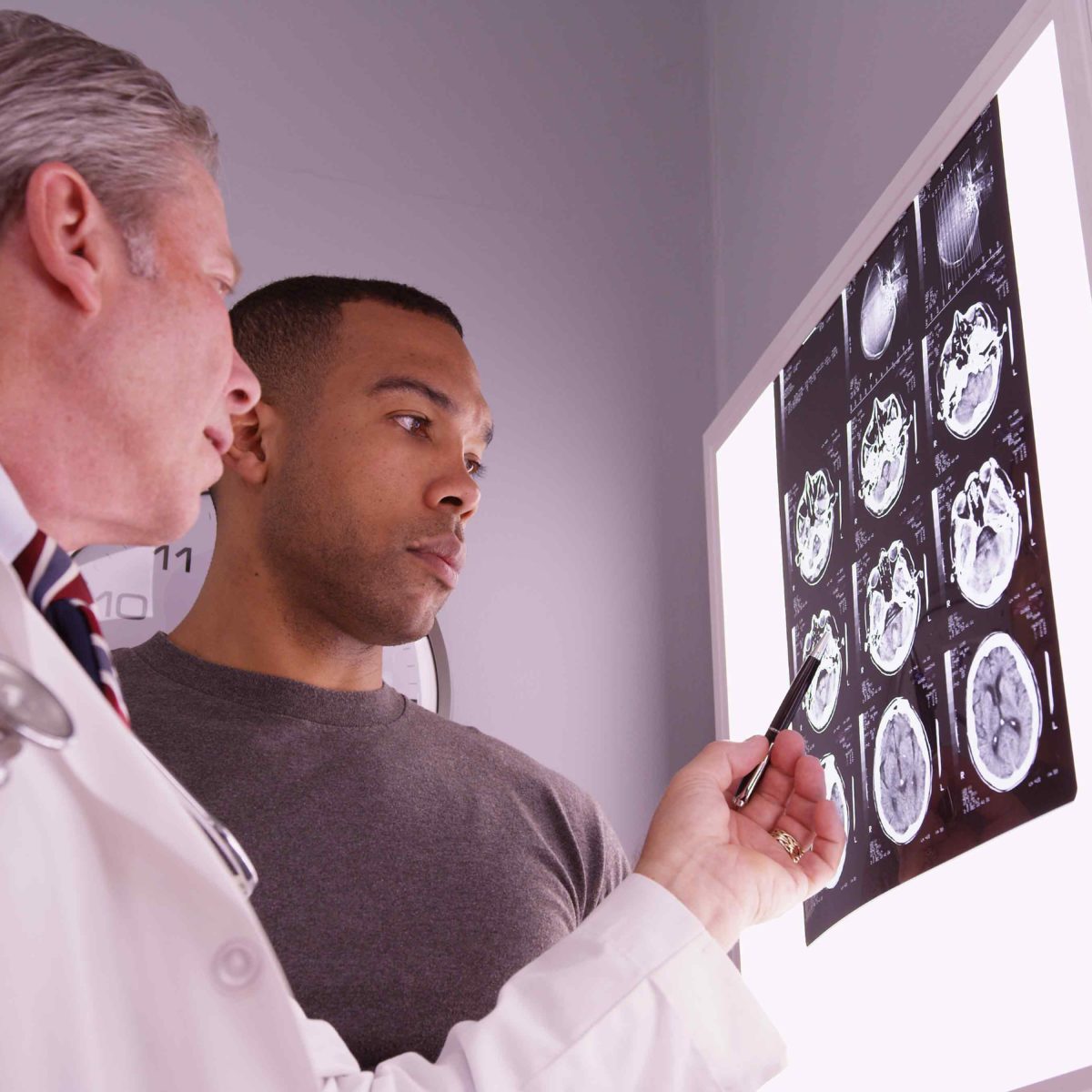 Implications of the Frontal Lobe in Concussions